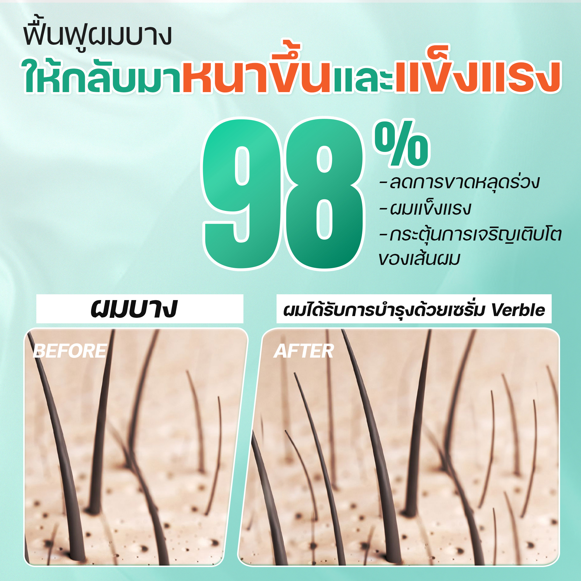 HAIR SERUM VERBLE เซรั่มปลูกผม - เซรั่มดูแลเส้นผมสุดเพอร์เฟค 35ML ...