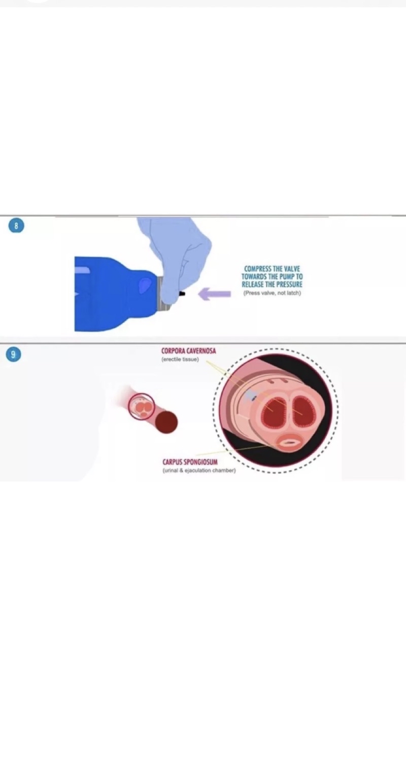 Bathmate X30 Xtreme Hydroxtreme7 Hydromax 7 Hydro7 | Shopee Thailand