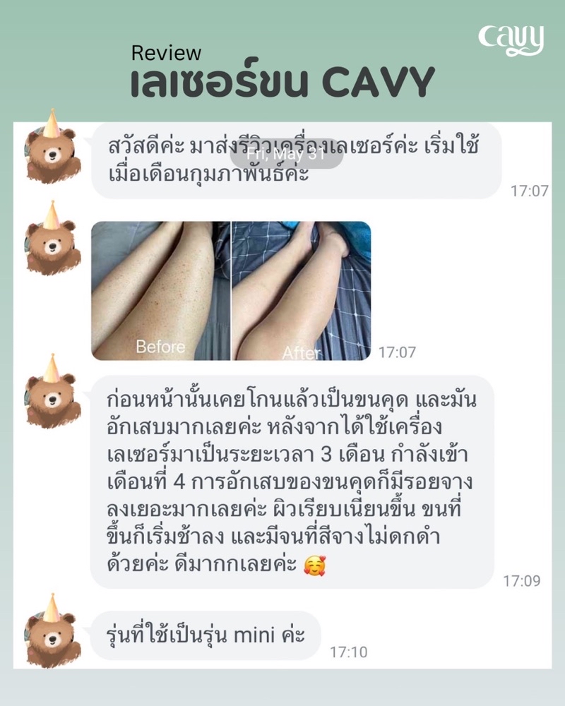 CAVY MINI IPL เครื่องเลเซอร์กำจัดขน หน้าใส ลดสิว 3 ฟังก์ชัน ไม่จำกัด ...