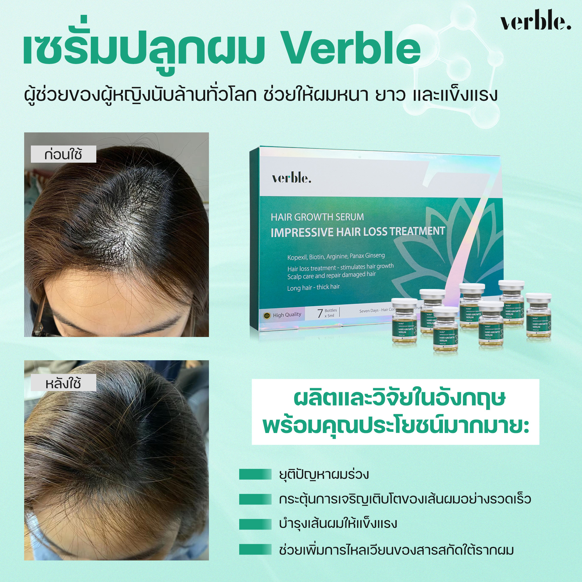 HAIR SERUM VERBLE เซรั่มปลูกผม - เซรั่มดูแลเส้นผมสุดเพอร์เฟค 35ML ...