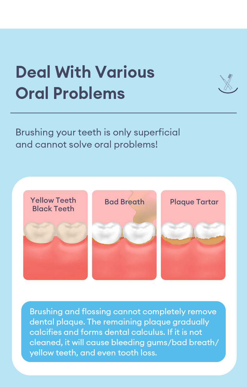 Airuidu M09 UltraSonic Toothbrush ที่ขูดหินปูน ขูดหินปูน เครื่องขูด ...