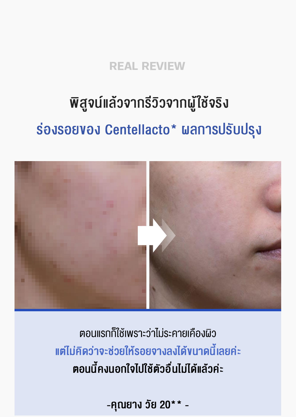 SUNGBOON EDITOR Centell Lacto AC Less Skin Barrier Essence 30ml ...