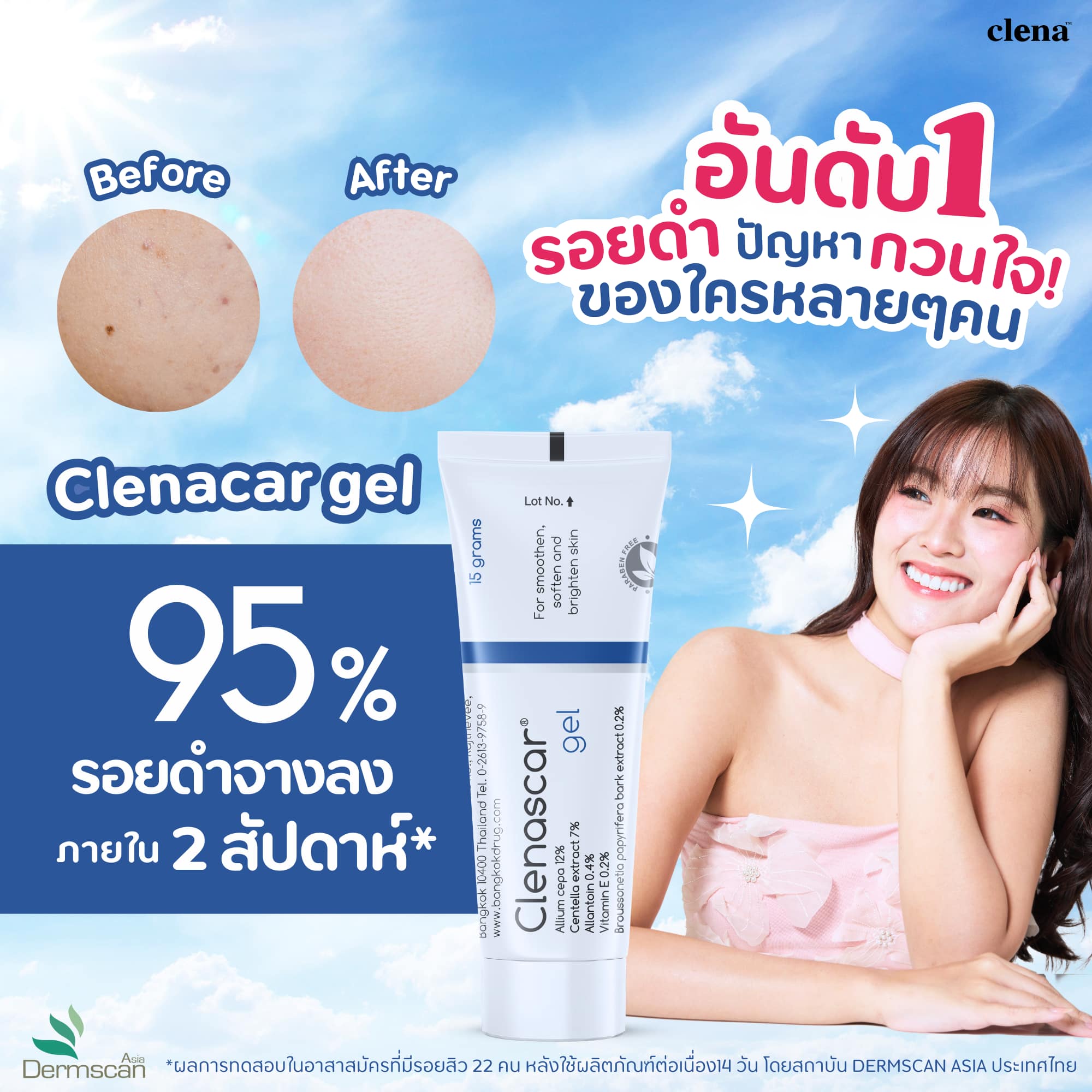 Clena Scar Gel Acne Scar and Dark Spot คลีน่าสการ์ เจล แอคเน่ สการ์ ดาร ...